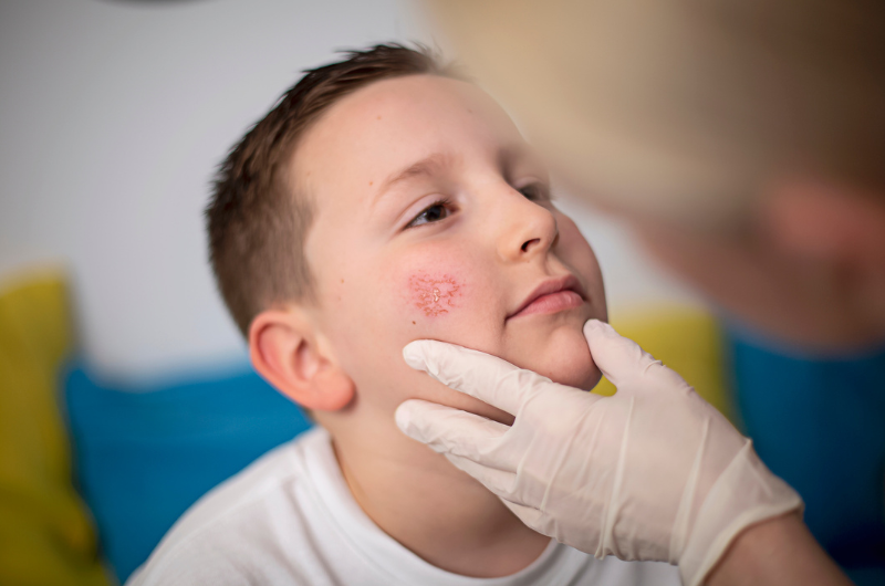 A doctor examines a rash on an adolescent boy’s face.